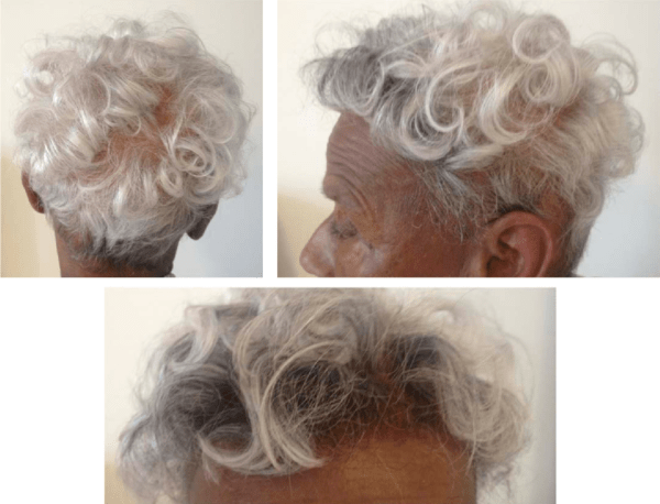 How to Repigment/ Reverse Grey Hair - Success Stories - The Research Files